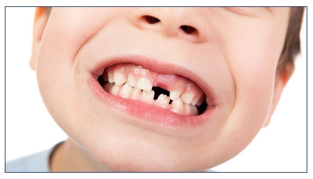 Step 2: Program Setup & Logistics | California Oral Health Technical ...